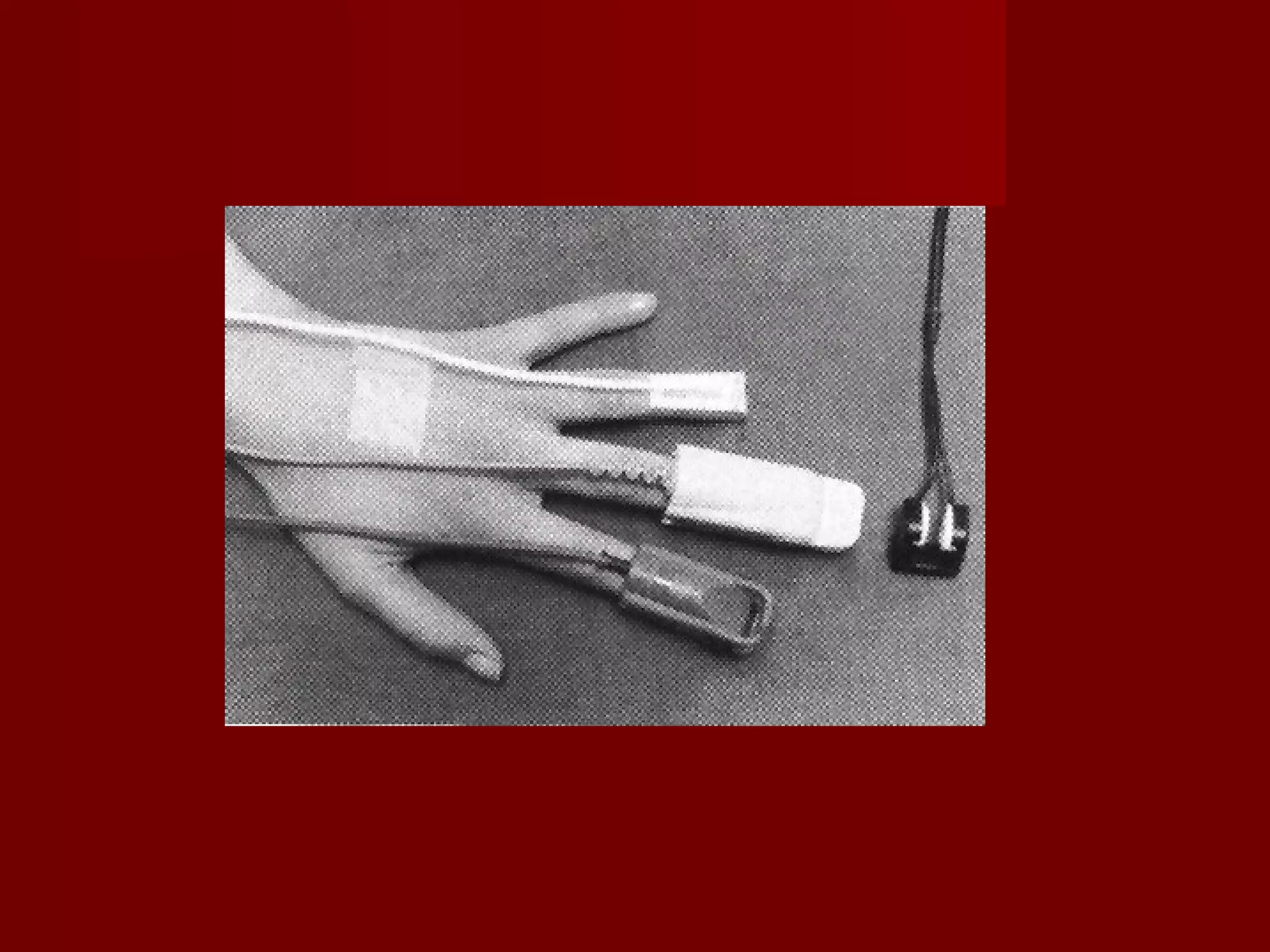 Bedside monitoring of tissue perfusion and oxygenation | PPT