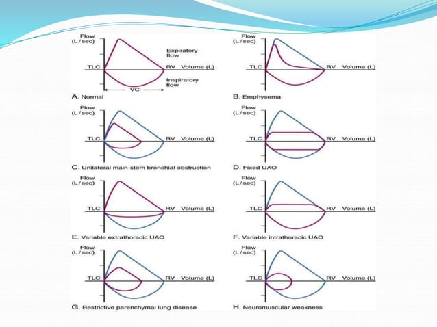 Bedside PULMONARY FUNCTION TEST/PFT | PPTX | Lung and Respiratory ...