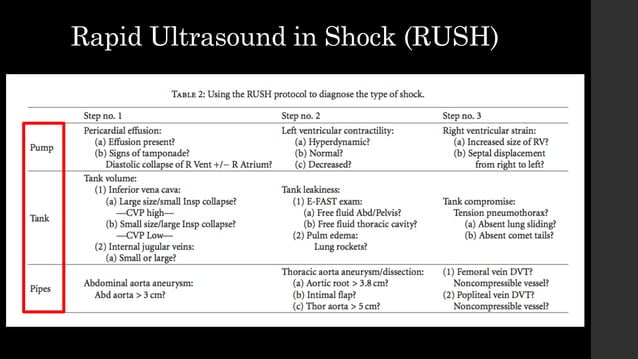 Ultrasound in undifferentiated shock | PDF