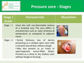 Bed Sore | PPT