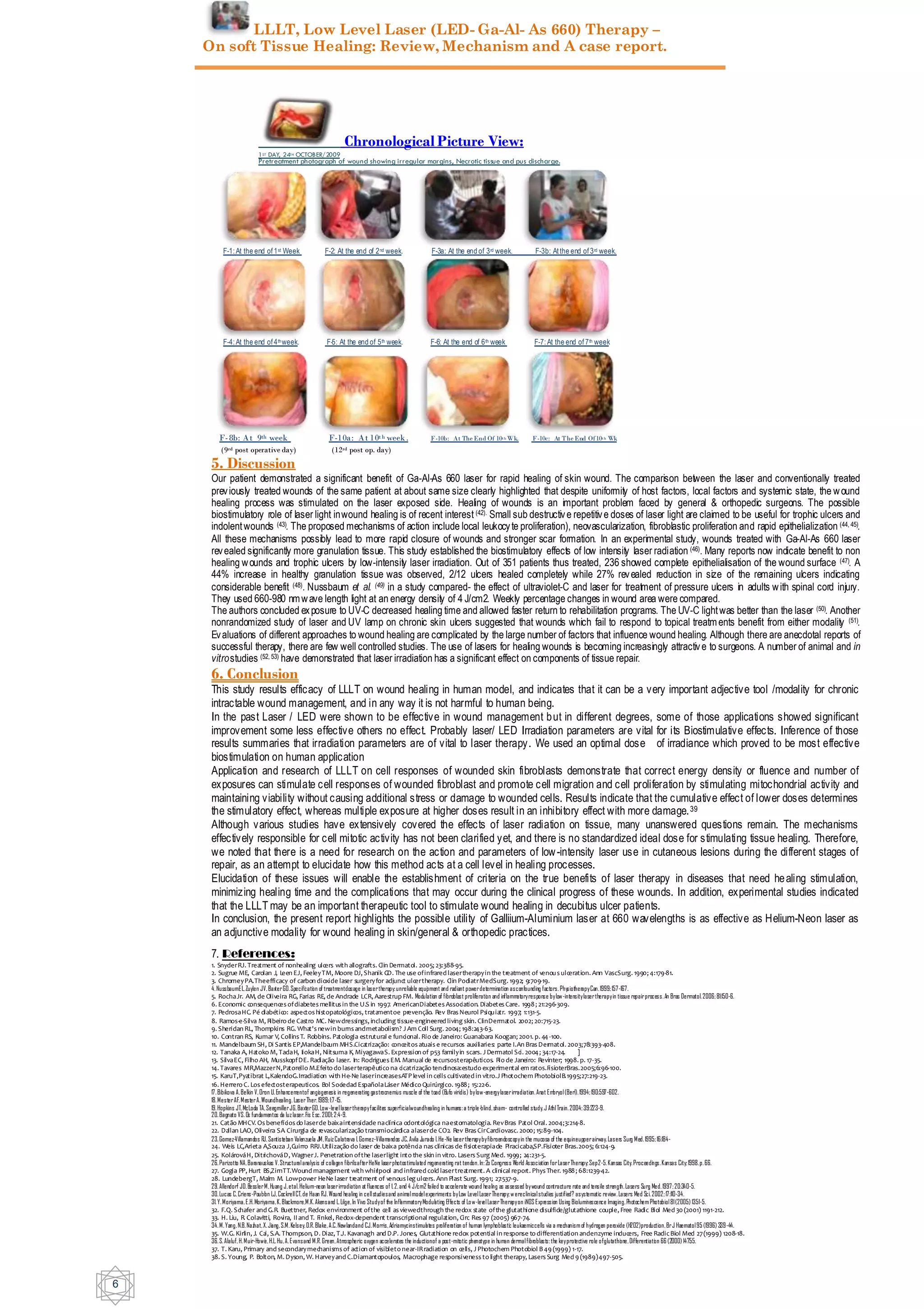 BEDSORE HEALING: Low Level Laser Therapy- LED( Ga-Al-As 660) on Soft ...