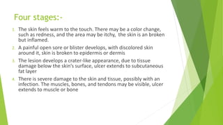 bed sore (pressure ulcers).pptx