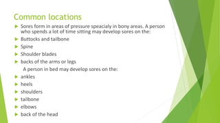 bed sore (pressure ulcers).pptx