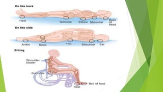 bed sore (pressure ulcers).pptx