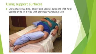 bed sore (pressure ulcers).pptx