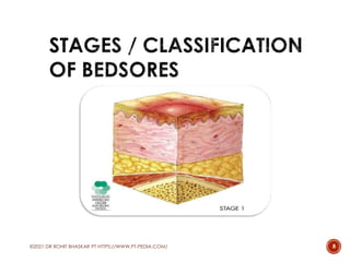 Bed Sores - Pressure Ulcers - Dr Rohit Bhaskar | PPT