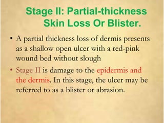 BED SORES-SCTE.ppt