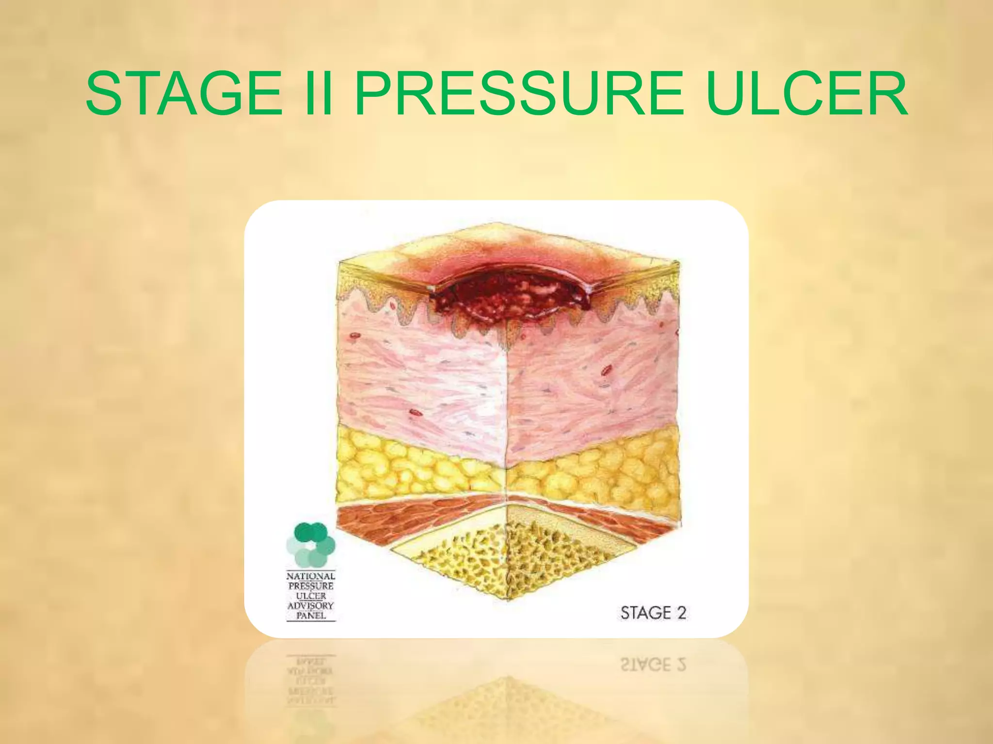 Bed sores / decubitis ulcer / pressure sores | PPTX