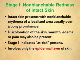 Bed sores / decubitis ulcer / pressure sores | PPTX