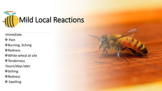Bee sting MANAGEMENT | PPTX