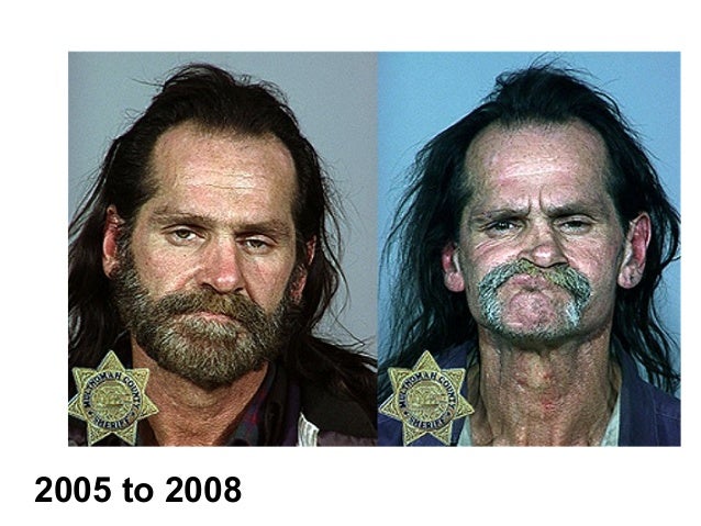 Before and after drugs