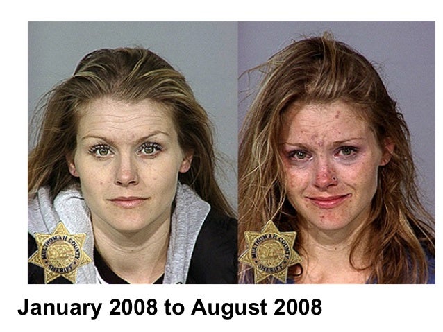 Before and after drugs