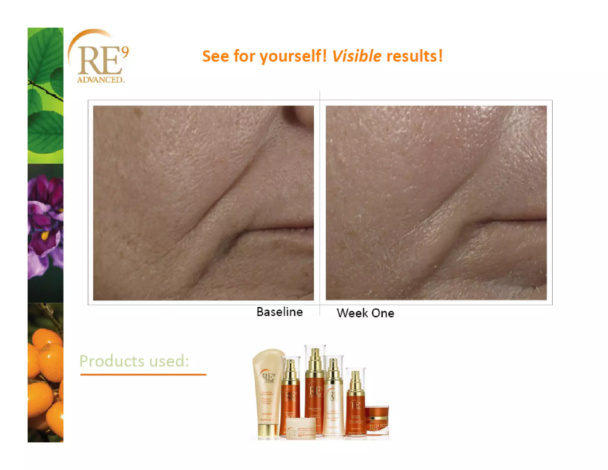 Arbonne Before And Afters Photos.September 2010 | PDF | Skin Care | Beauty