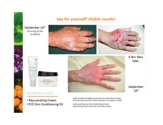 Arbonne Before And Afters Photos.September 2010 | PDF | Skin Care | Beauty