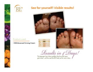 Arbonne Before And Afters Photos.September 2010 | PDF | Skin Care | Beauty