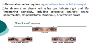 Before neonatal discharge | PPTX