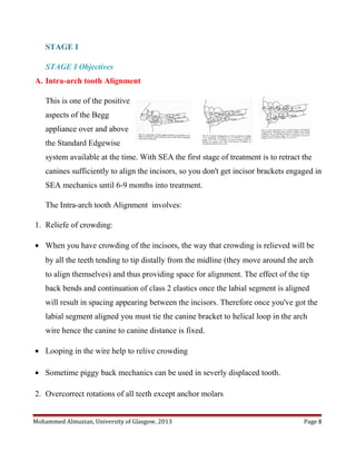 Begg mechanics / for orthodontists by Almuzian | PDF