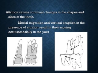 Begg’s philosophy and technique | PPT