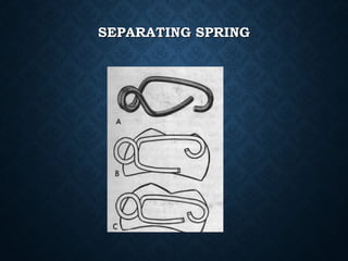 Begg’s philosophy and technique | PPT