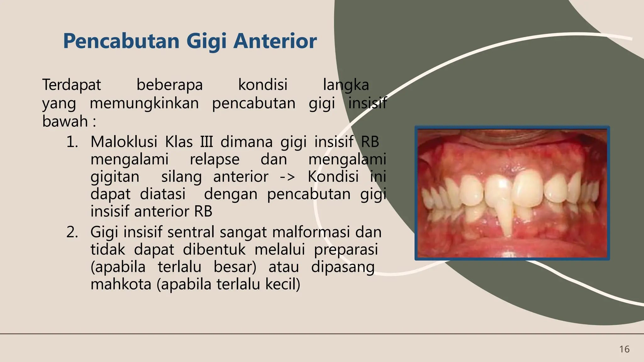 Power Point Teknik Orthodontik Teknik Begg Ch 10 | PPTX