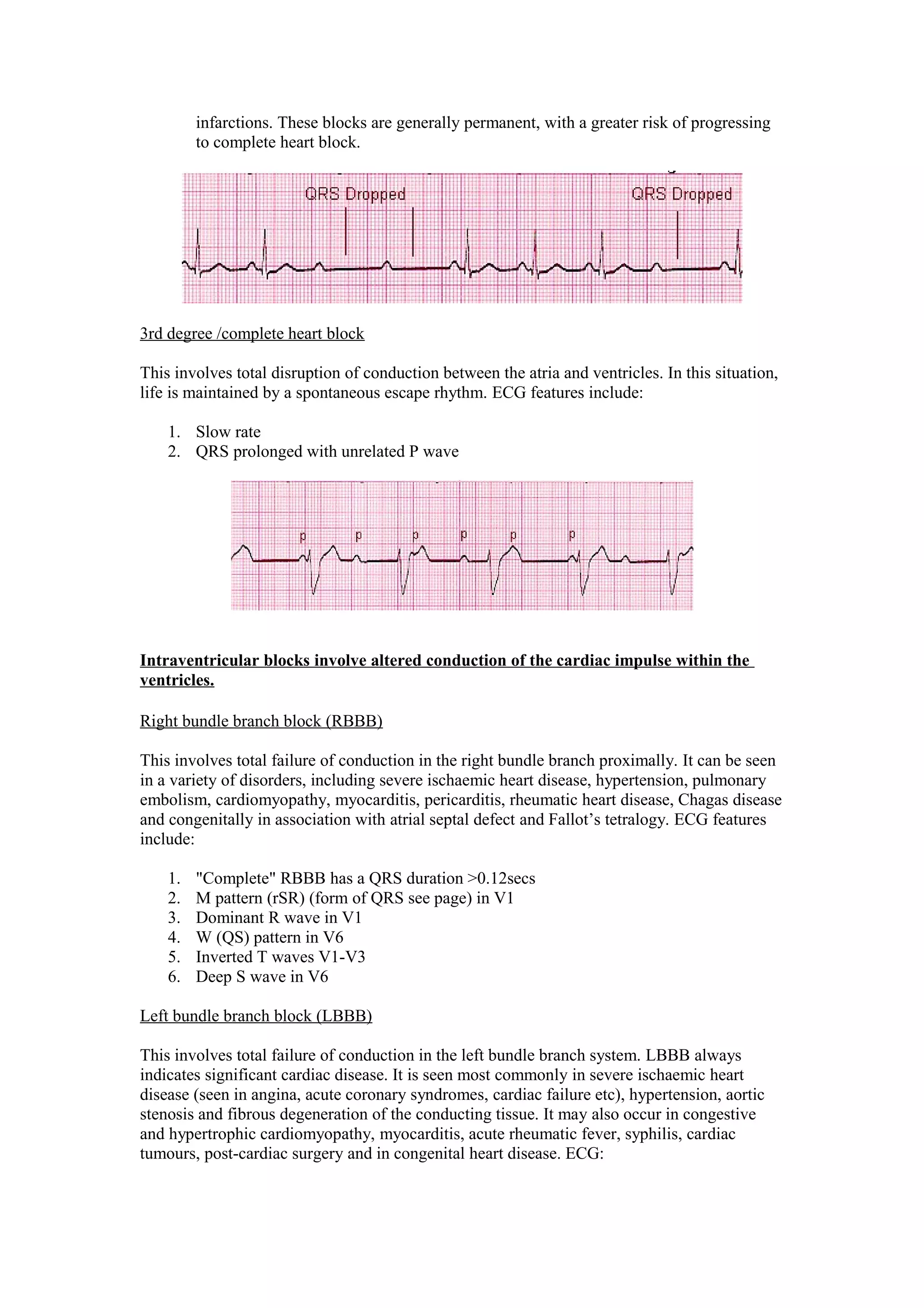 Beginners Guide for ECG Interpretation | DOC | Heart and Cardiovascular Diseases | Diseases and ...