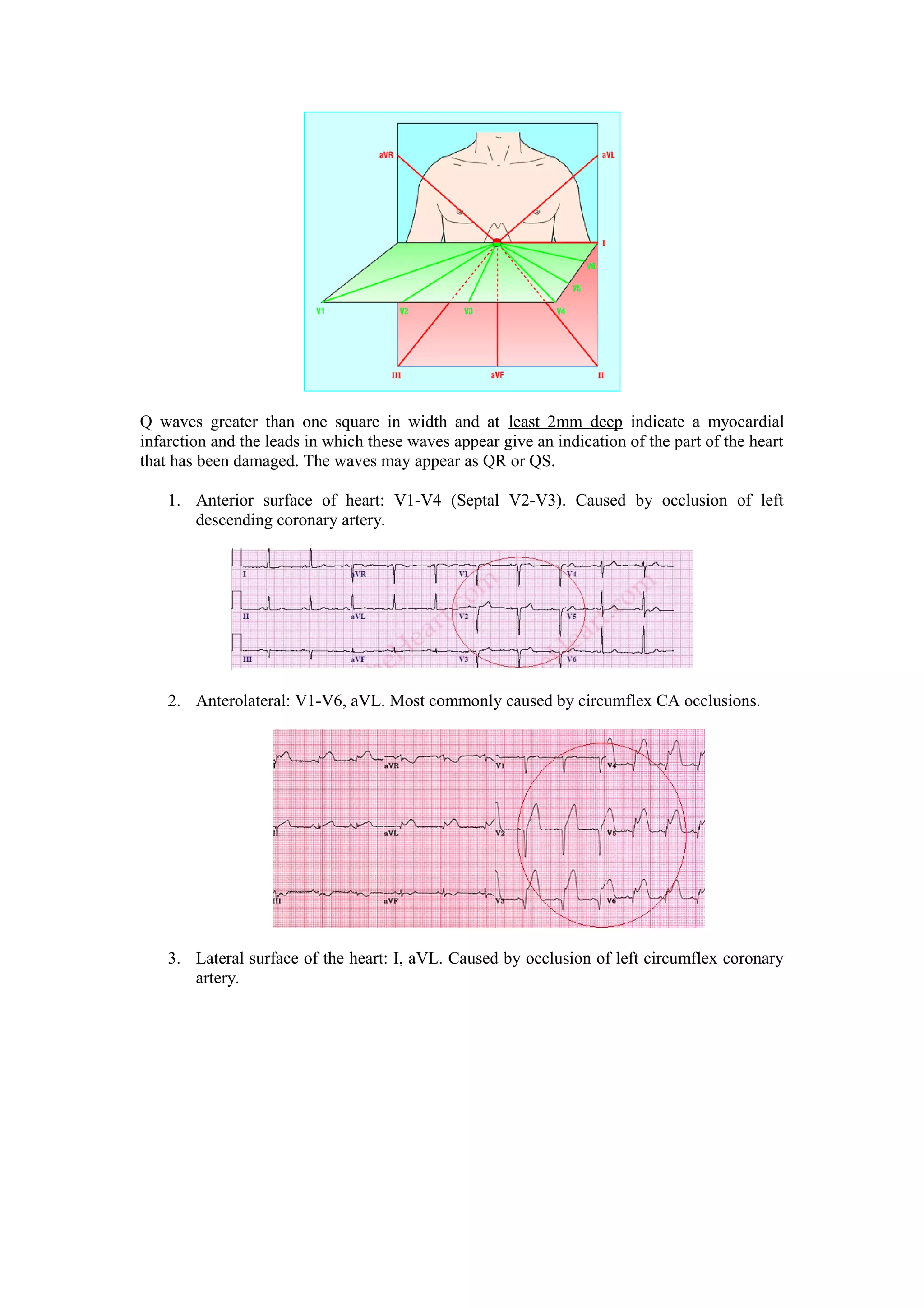 Beginners Guide for ECG Interpretation | DOC | Heart and Cardiovascular ...