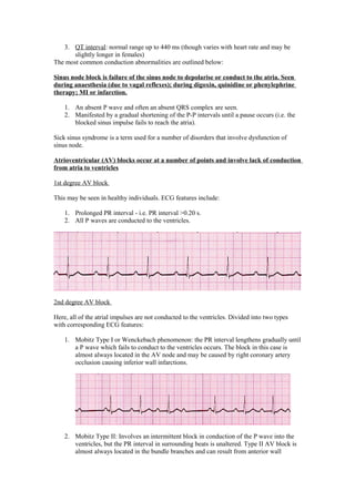Beginners Guide for ECG Interpretation | DOC | Heart and Cardiovascular Diseases | Diseases and ...