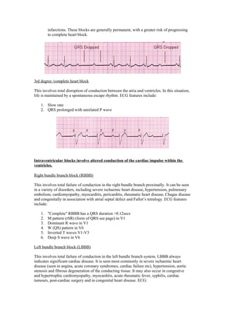 Beginners Guide for ECG Interpretation | DOC | Heart and Cardiovascular ...
