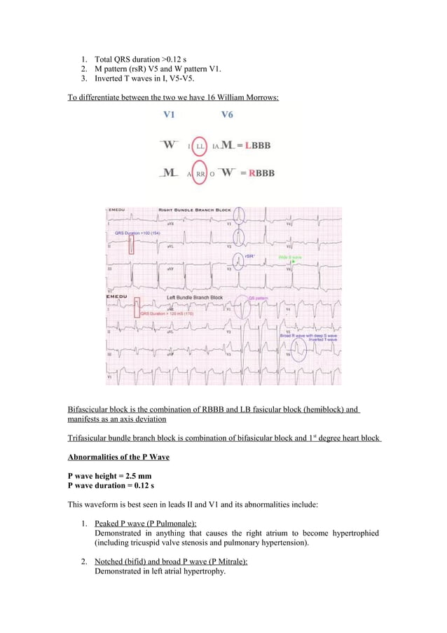 Beginners Guide for ECG Interpretation | DOC | Heart and Cardiovascular Diseases | Diseases and ...