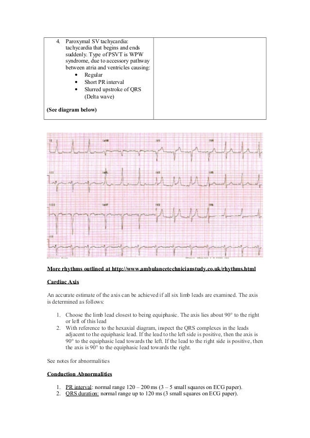 Beginners Guide for ECG Interpretation