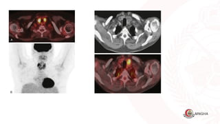 Beginner’s Guide to PET CT , The new link . | PDF