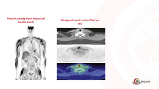 Beginner’s Guide to PET CT , The new link . | PDF