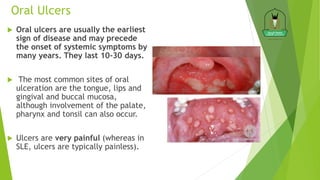 Behcet-disease.pdf