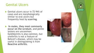 Behcet-disease.pdf
