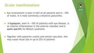 Behcet-disease.pdf