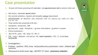 Behcet-disease.pdf