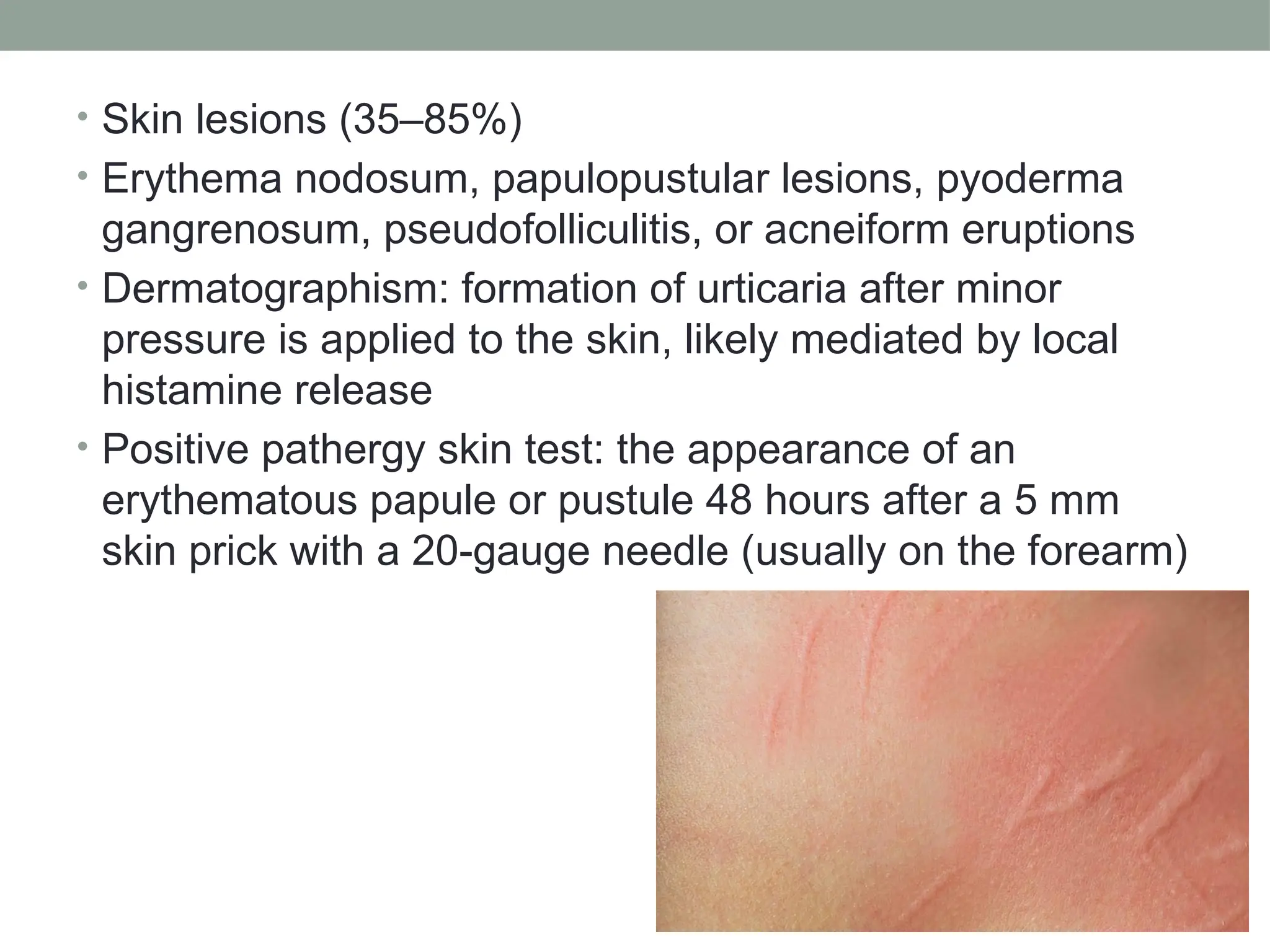 Behcet disease presentation .pptx