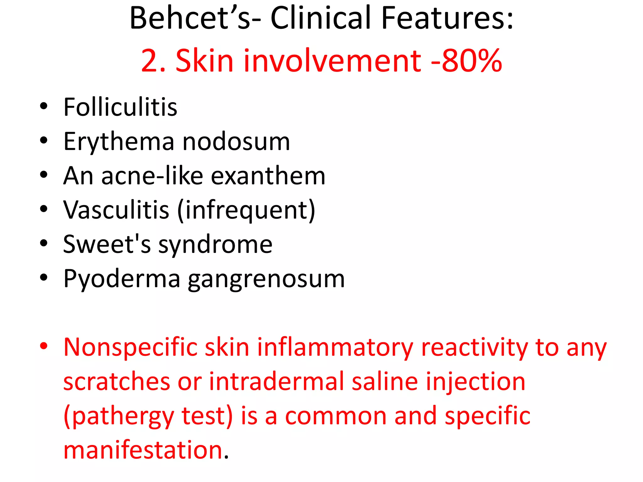Behcet's Disease | PPTX