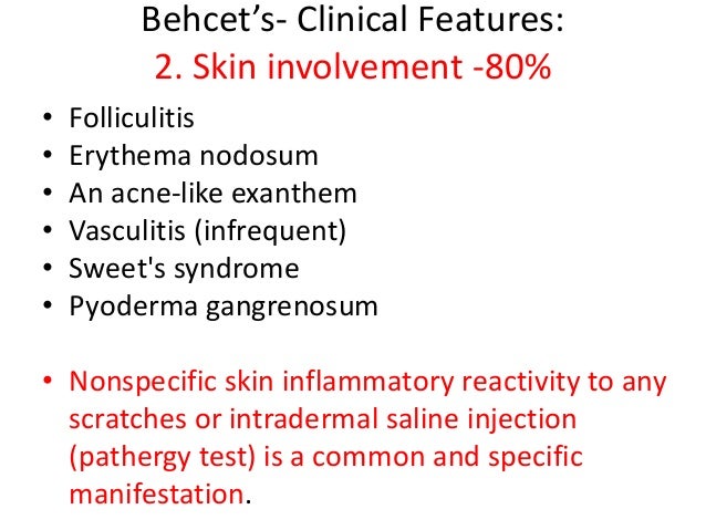 Behcet's Disease