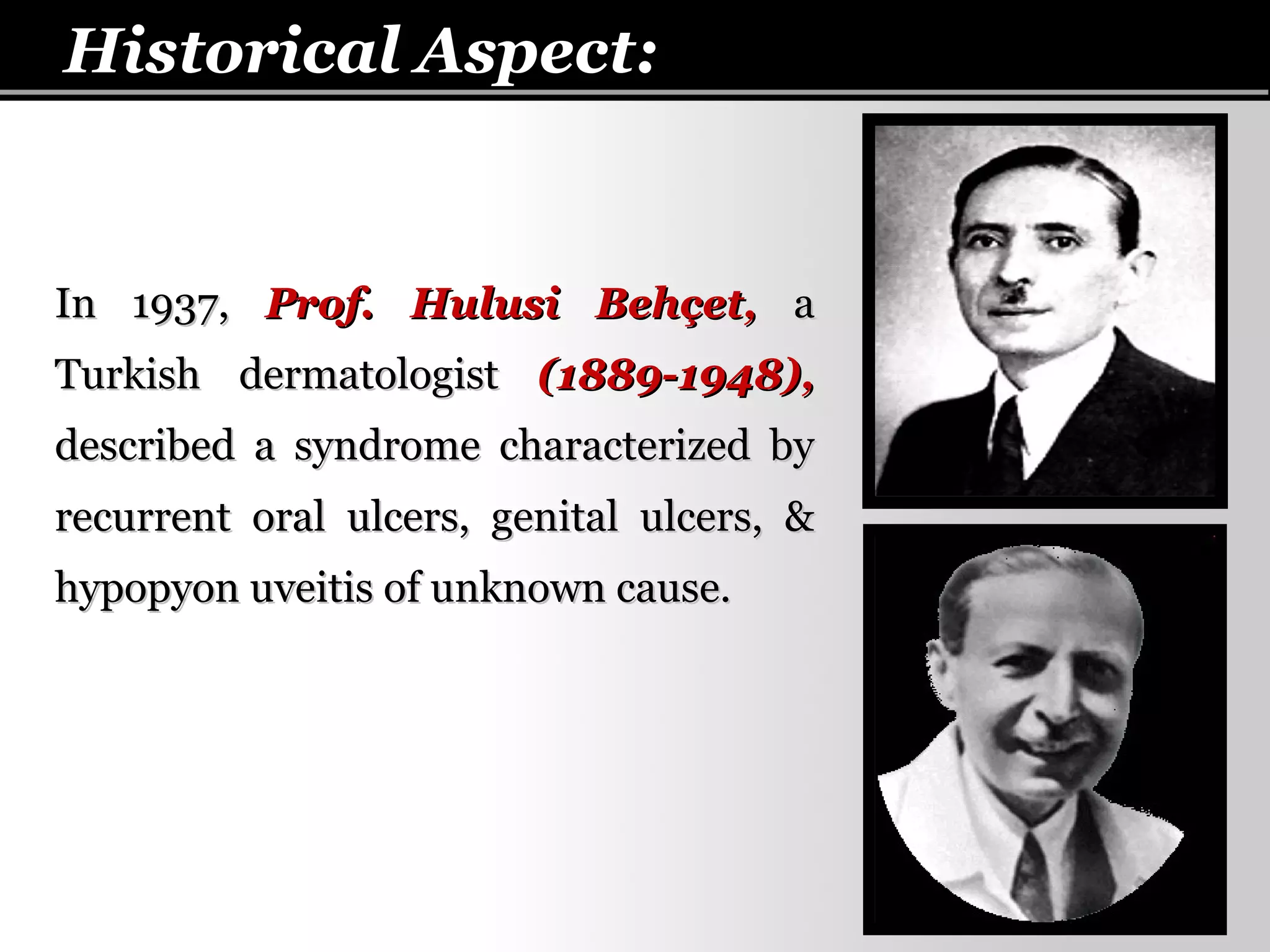 Behcet’s disease | PPT