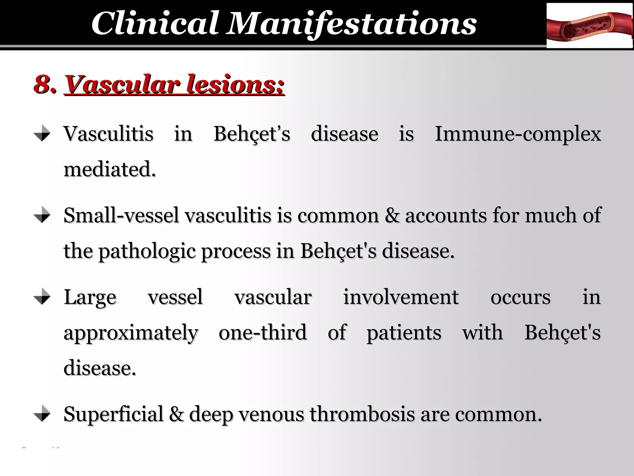 Behcet’s disease | PPT