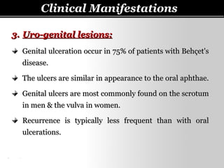 Behcet’s disease | PPT