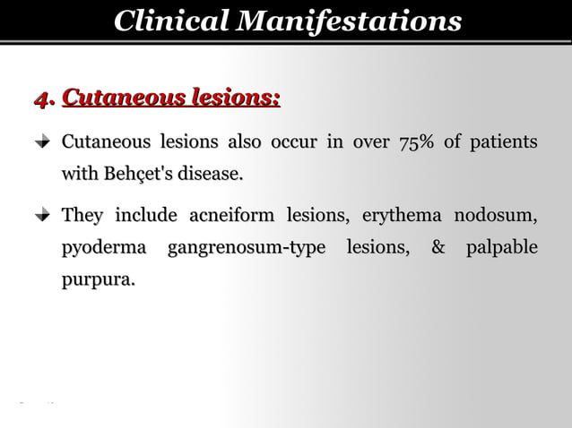 Behcet’s disease | PPT | Eye and Vision Conditions | Diseases and ...