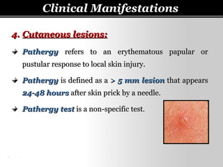 Behcet’s disease | PPT