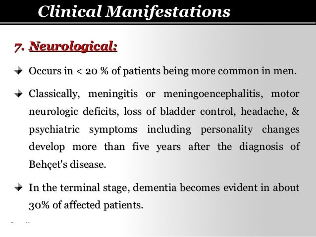 Behcet’s disease Behcet’s disease