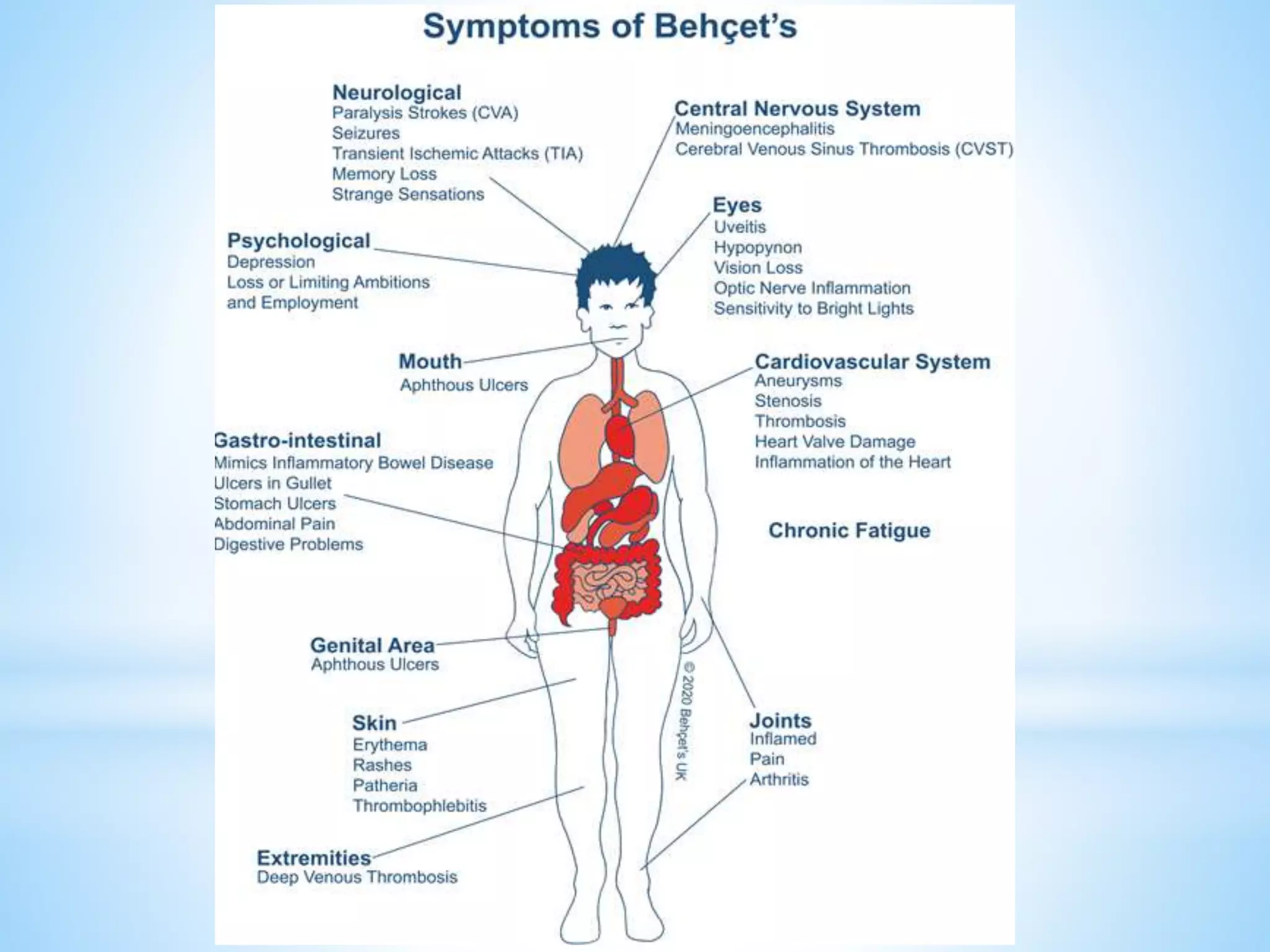 Behcet's disease | PPTX