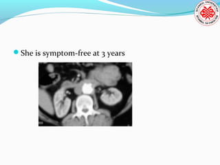 Behcet s disease new concepts in vascular involvements | PPT