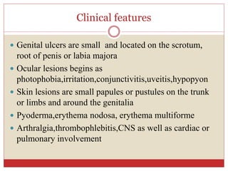 Behcet _s_syndrome_reiter___s_syndrome_and_sarcoidosis | PPT