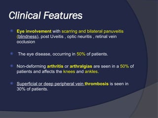 Behcet's syndrome for medical student revised | PPTX | Digestive ...