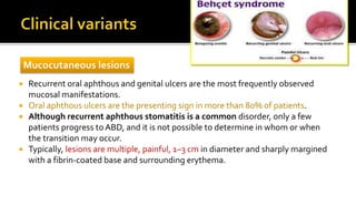 Behçet Disease.pptx